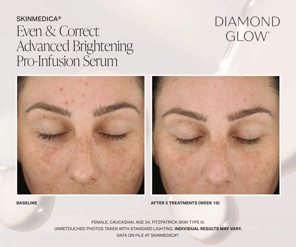Diamond Glow - Integrated Med Spa